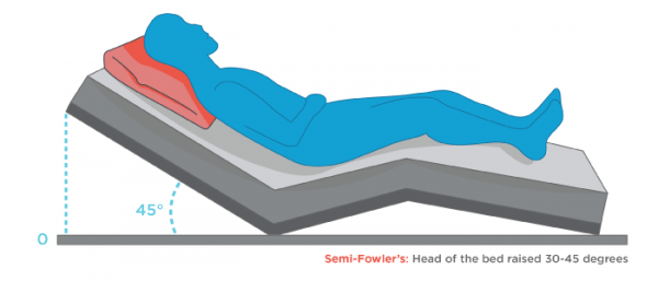 Patient positioning | Fowler's position and its variants