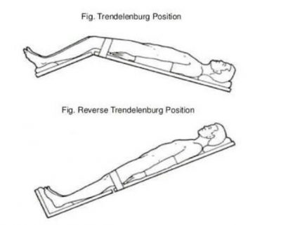 Patient Positioning | Trendelenburg and Reverse Trendelenburg