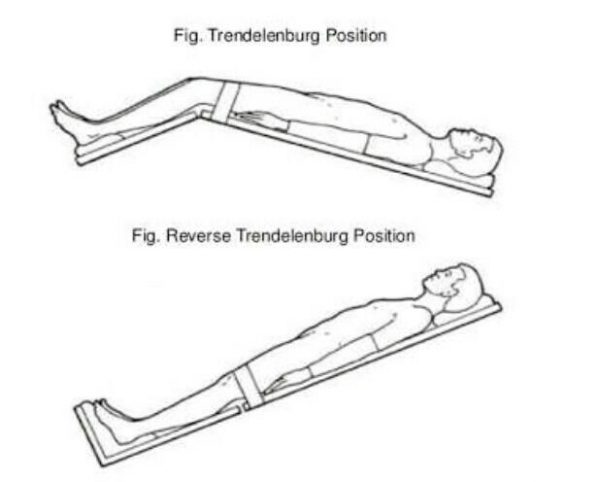Patient Positioning | Trendelenburg and Reverse Trendelenburg